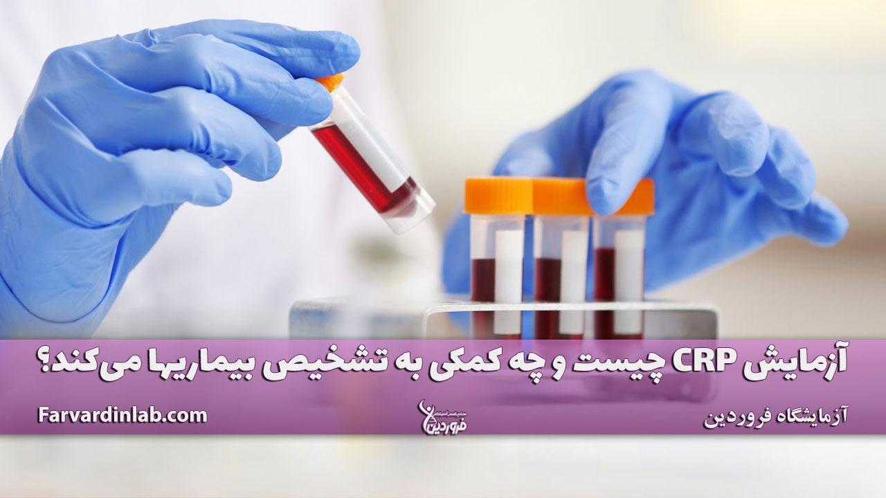 تست CRP چیست ؟ در تشخیص بیماری‌ها چه کاربردی دارد؟ - آزمایشگاه پاتوبیولوژی و ژنتیک پزشکی فروردین